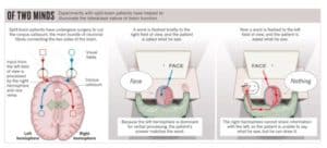 What Are Split Brain Experiments? - Edublox Online Tutor