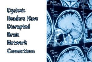 Dyslexic Readers Have Disrupted Brain Network Connections - Edublox ...